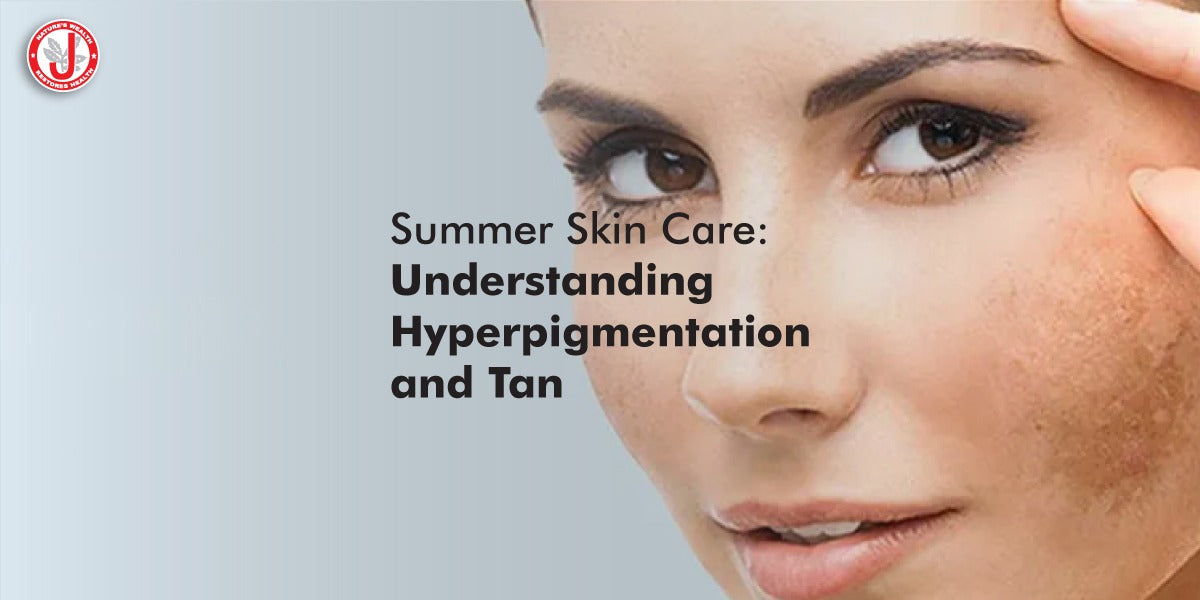 Summer Skin Care: Understanding Hyperpigmentation and Tan – Caredura Store
